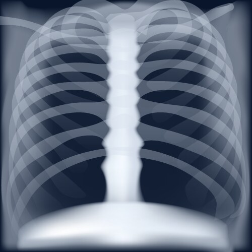 Chest X-Ray Vector Images (over 2,900)