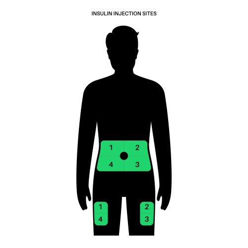 Insulin Injection Sites Vector Images (46)