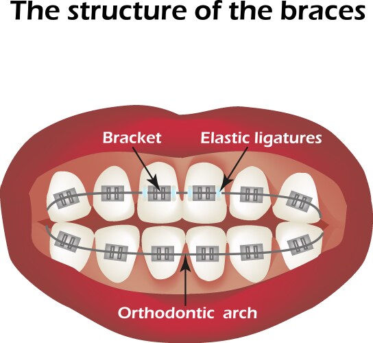 Orthodontics Vector Images (over 18,000)