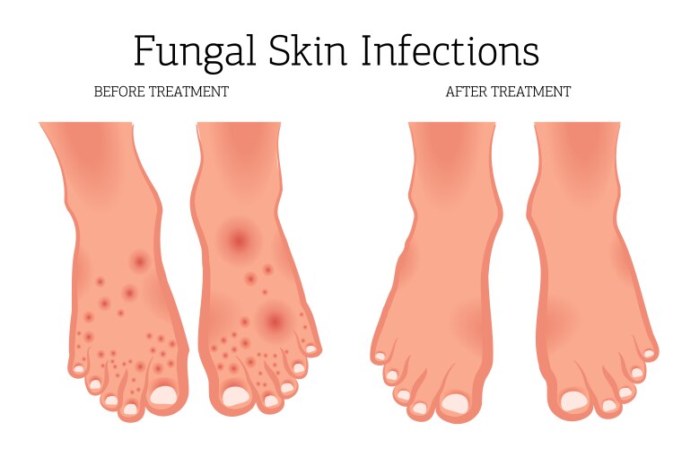 Fungal Vector Images (over 2,600)