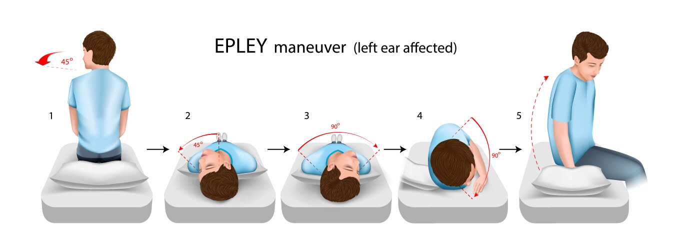 Epley maneuver right ear affected Royalty Free Vector Image
