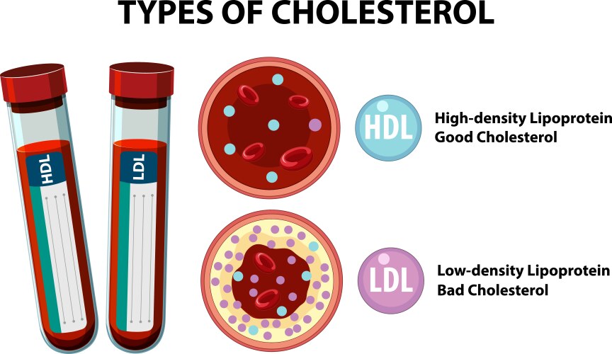 Hdl and ldl cholesterol types Royalty Free Vector Image