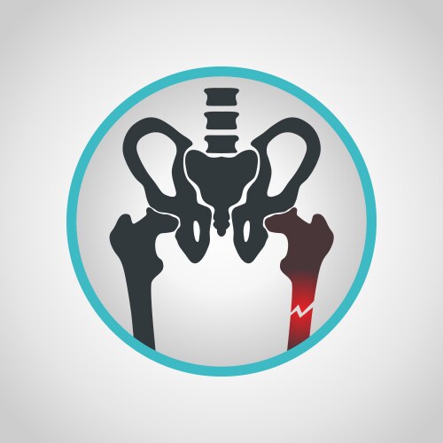 Fracture Vector Images (over 56,000)