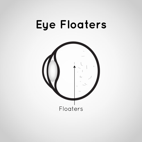 Eye Floaters Vector Images (71)