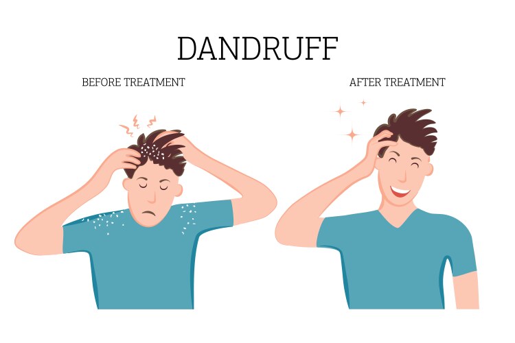 Dandruff Vector Images (over 3,200)