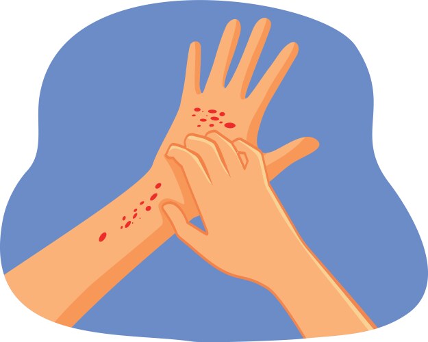 Scratching Vector Images (over 560,000)