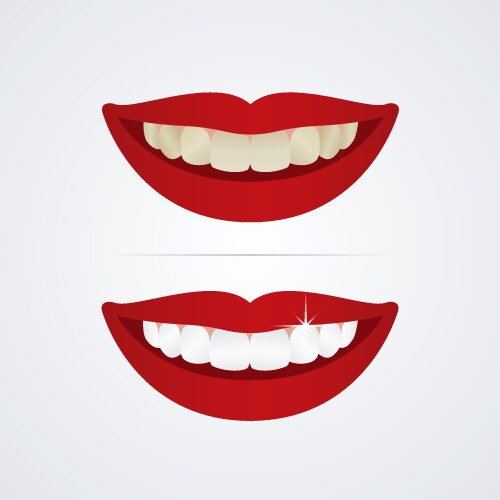 Teeth Vector Images (over 150,000)
