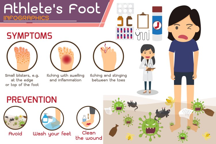 Athletes foot or hong kong disease Royalty Free Vector Image