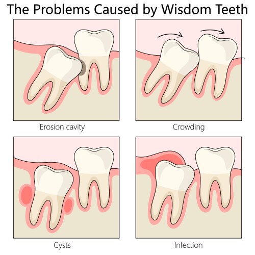 Dental problems infographic template with damaged Vector Image