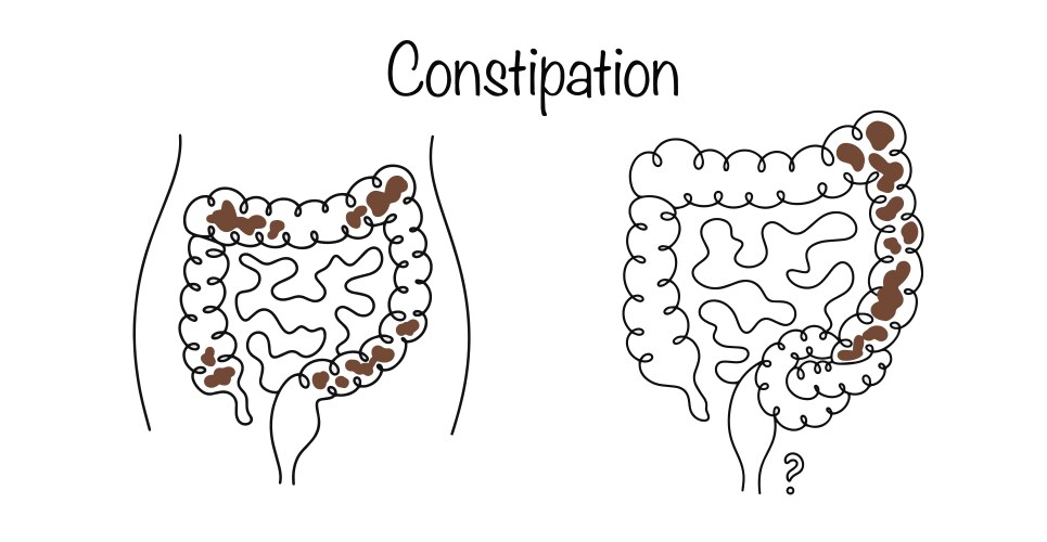 Constipation Vector Images (over 5,300)