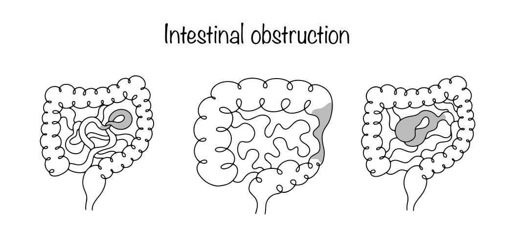 Intestinal Vector Images (over 19,000)