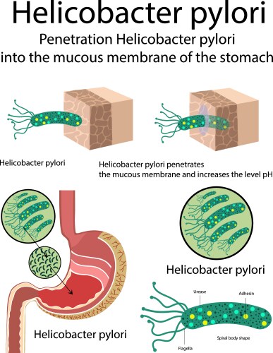 Structure of helicobacter pylori infographics Vector Image