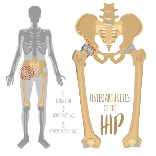Human hip bones Royalty Free Vector Image - VectorStock