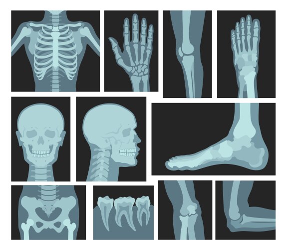 Different x-rays shot human body part set Vector Image
