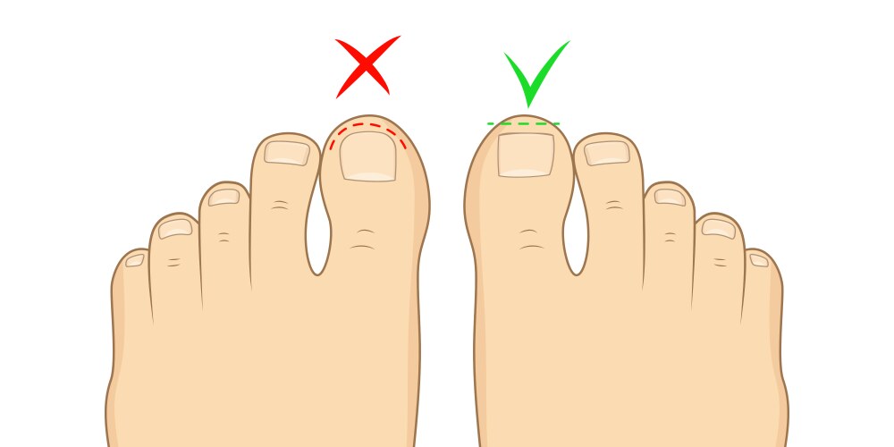 How to cut toenails correctly Royalty Free Vector Image