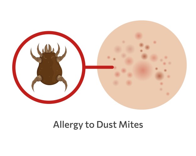 Dust Mites Logo Vector Images (over 400)
