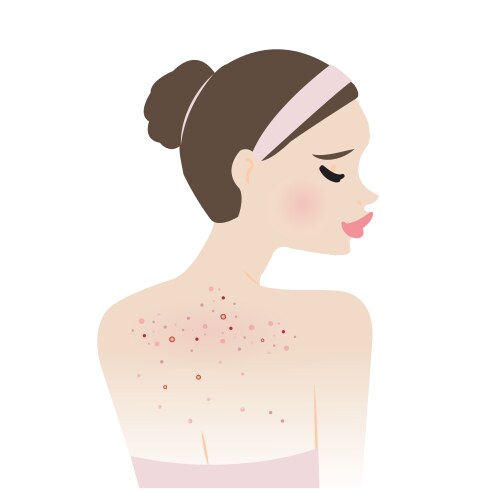 Acne Scars Vector Images (over 1,000)