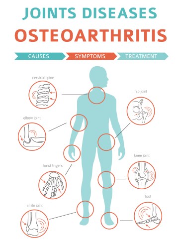 Joints diseases arthritis osteoarthritis symptoms Vector Image