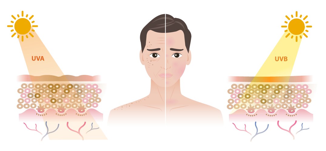 UVA & UVB Damage to Skin – Royalty-Free Vector | VectorStock