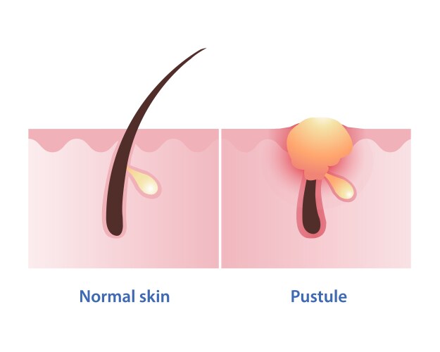 Structure of stratum corneum Royalty Free Vector Image