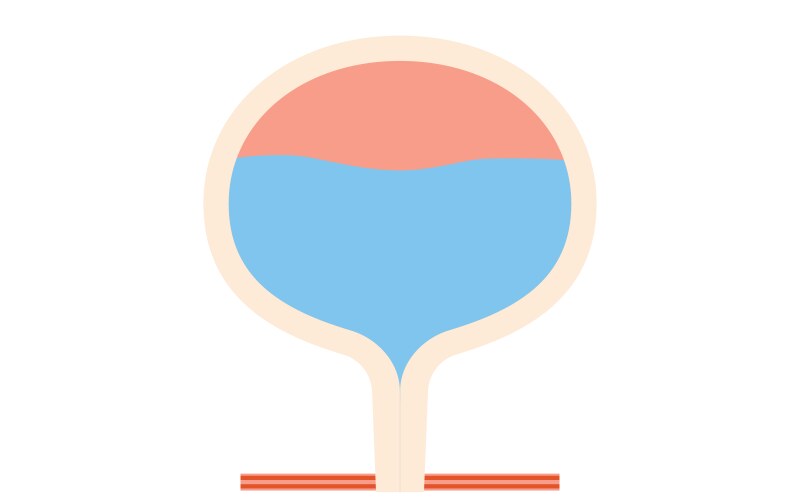 Medical of overactive bladder a condition Vector Image