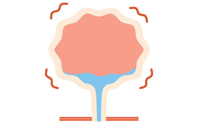 Medical of overactive bladder a condition Vector Image