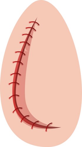 Incision suture icon cartoon style Royalty Free Vector Image