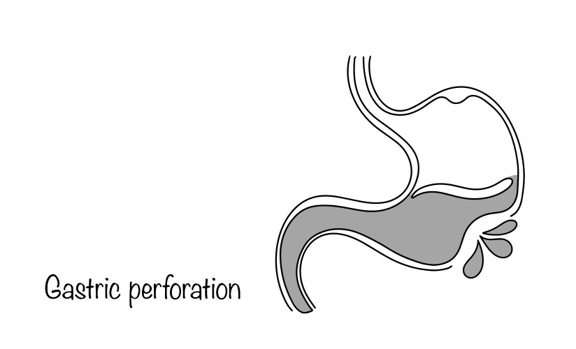 Esophagus Vector Images (over 2,900)