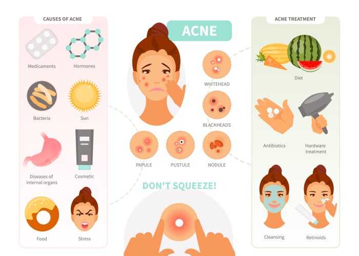 Acne Infographic Vector Images (over 940)
