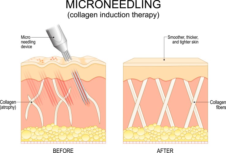 Revitalize Vector Images (over 1,000)