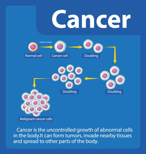 Cancer development process infographic Royalty Free Vector