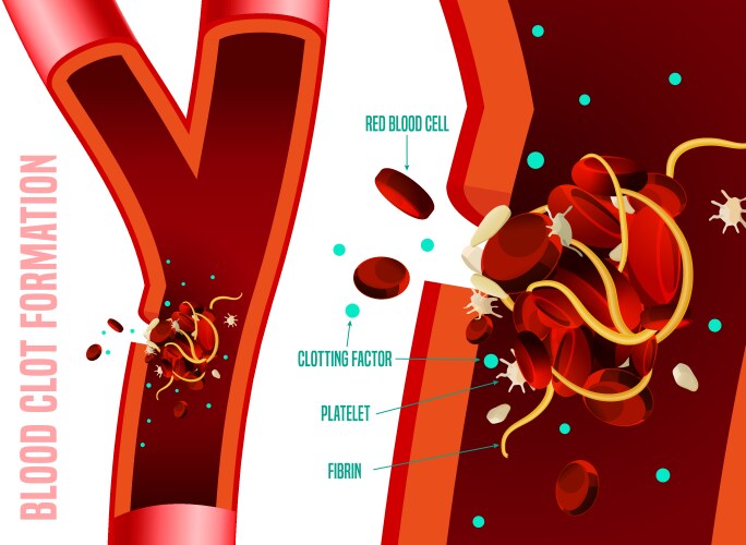 Blood clot formation Royalty Free Vector Image