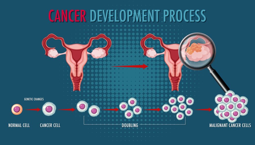 Cancer development process infographic Royalty Free Vector