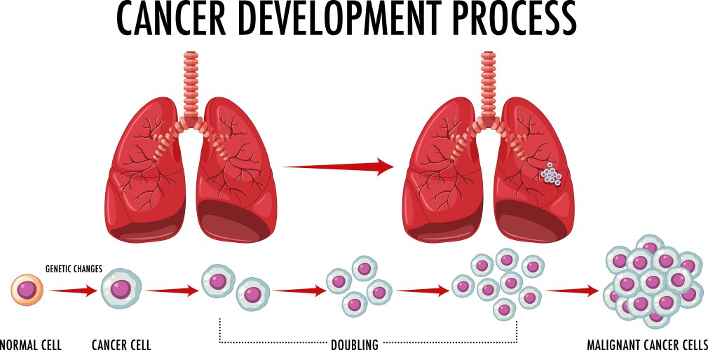 Process of cancer development infographic Vector Image
