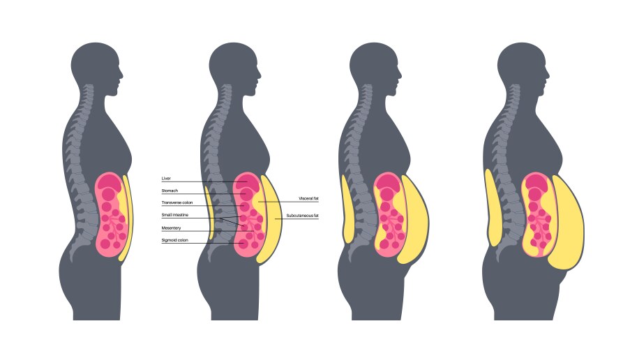 Subcutaneous and visceral fat diagram Royalty Free Vector