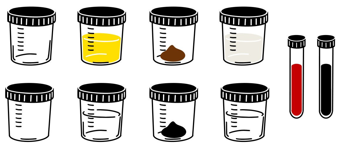 Urine Sample Vector Images (over 840)