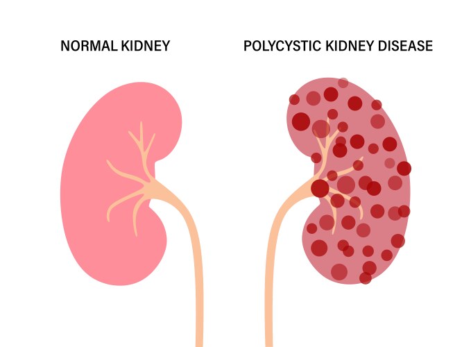 Kidney Anatomy Diagram Royalty Free Vector Image