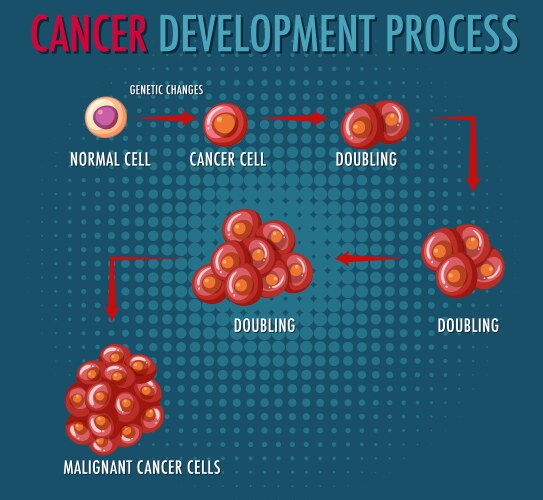 Process of cancer development infographic Vector Image