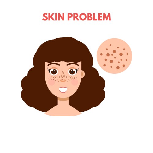 Skin Abscess Vector Images (over 160)