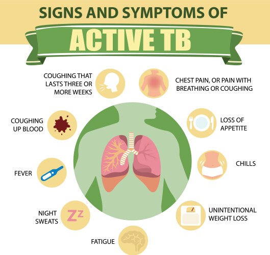 Signs and symptoms lung cancer detailed Royalty Free Vector