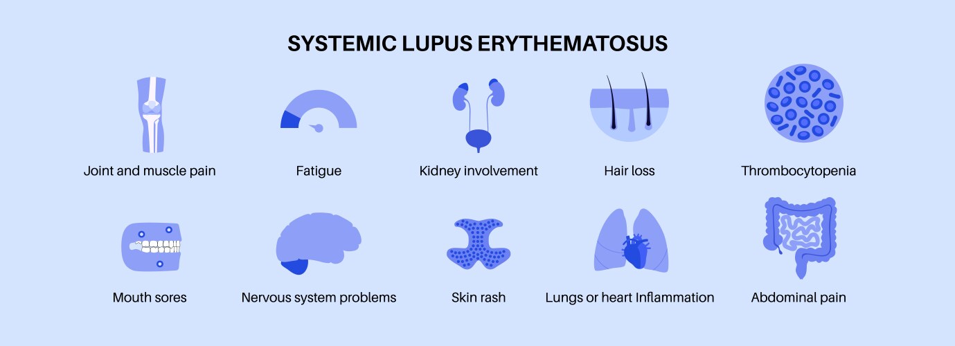 Systemic lupus erythematosus Royalty Free Vector Image