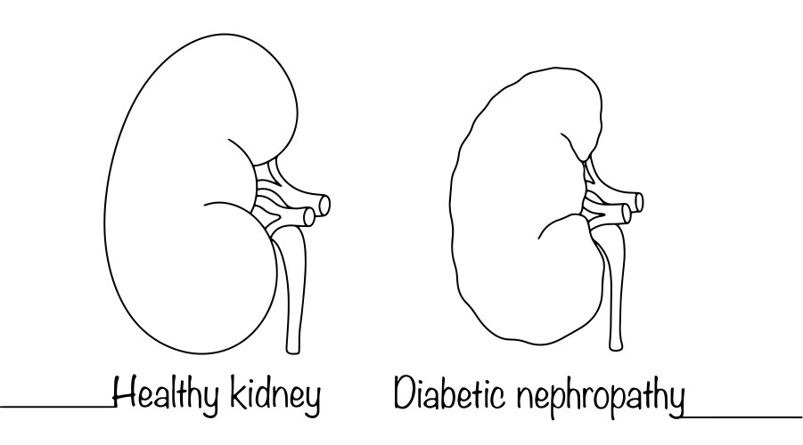 Kidney Poster Vector Images (over 1,800)