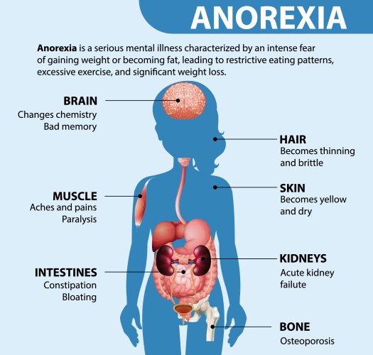 Anorexia Eating Disorder Awareness Poster – Royalty-Free Vector ...
