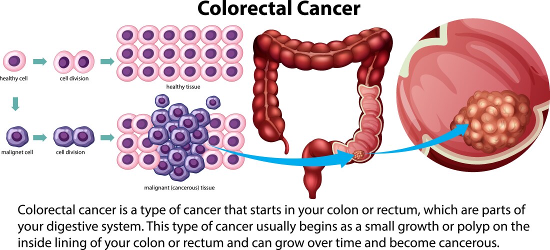 Pathology Vector Images (over 12,000)