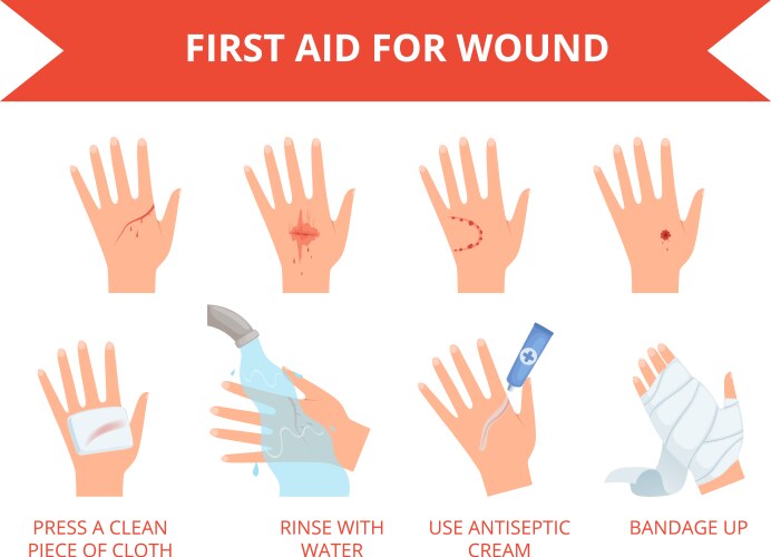 Burns degree first aid for burn wound fire Vector Image