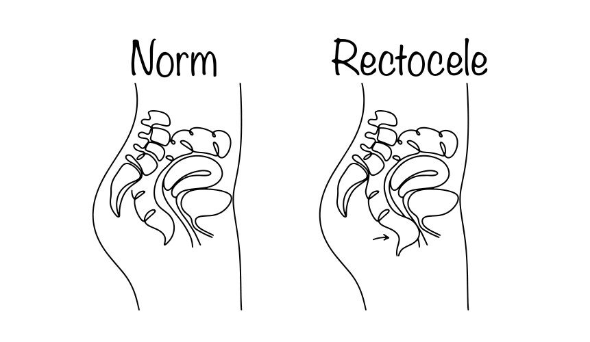Line Drawing Body Organs Vector Images (over 3,400)