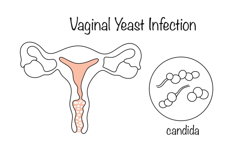 Vaginal Discharge Vector Images (74)