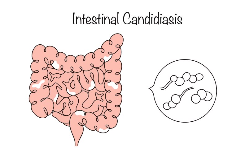 Intestinal Vector Images (over 19,000)