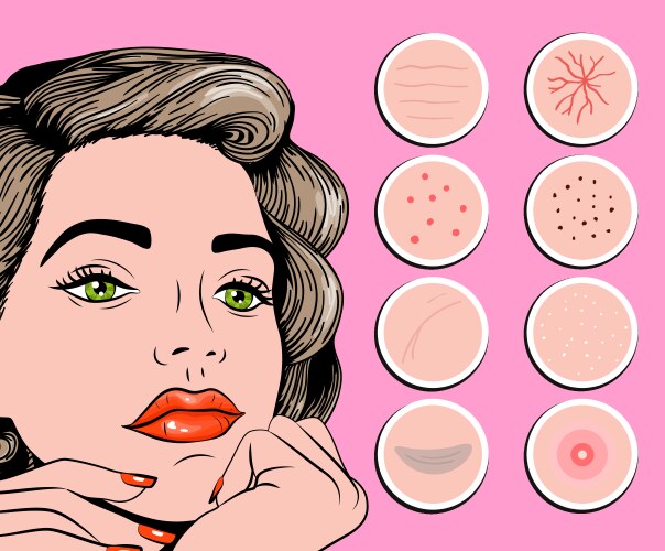 Acne Infographic Vector Images (over 940)