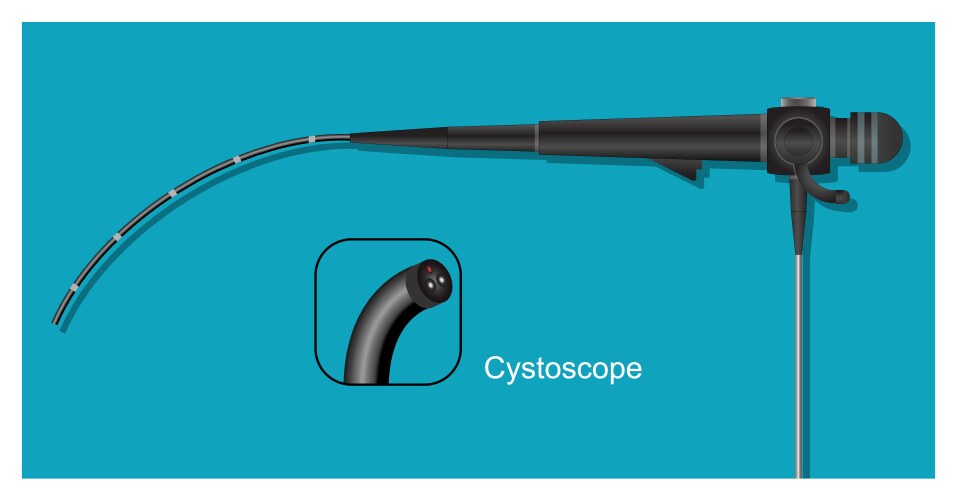 Endoscopy Vector Images (over 1,300)